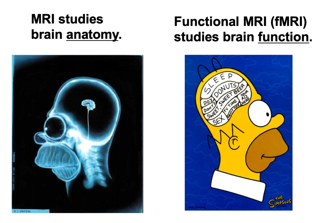MRI和fMRI的区别：脑结构与脑功能的区别 - 墨天轮