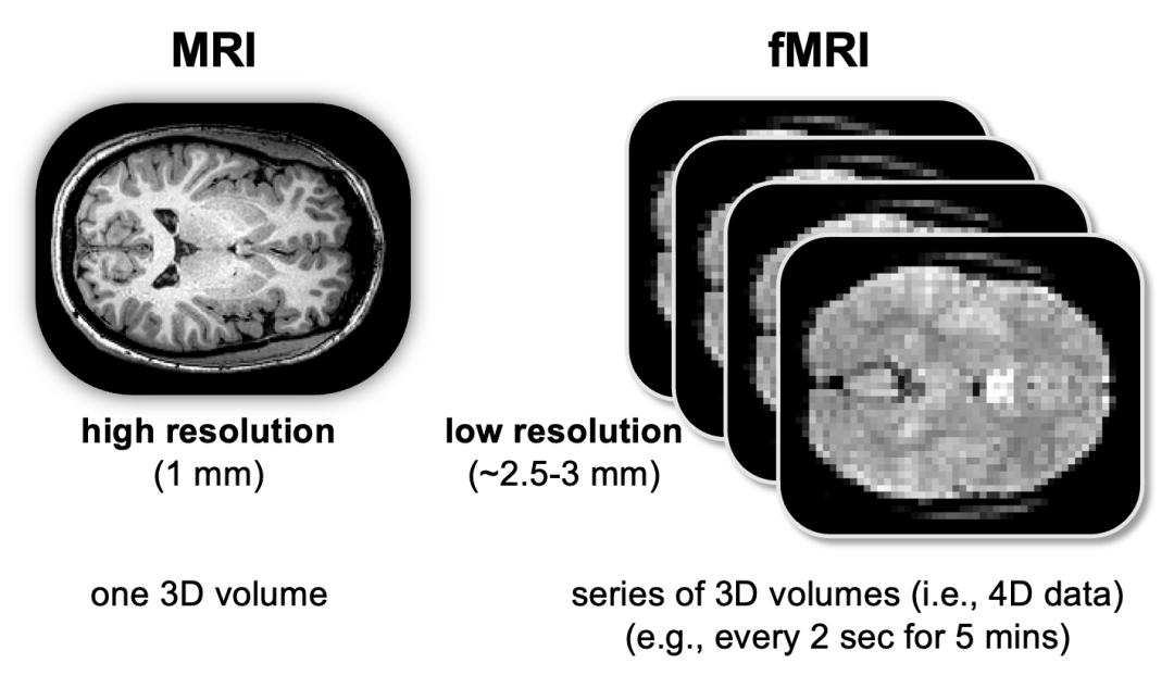 MRI和fMRI的区别：脑结构与脑功能的区别 - 墨天轮