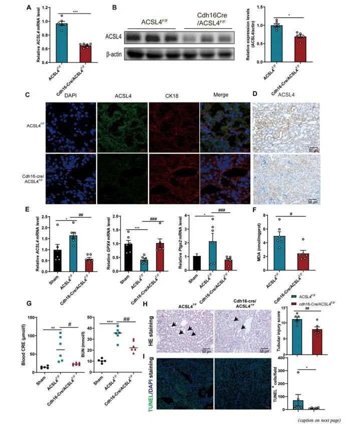 Redox Biol | ACSL4缺乏对铁死亡介导的急性肾损伤具有保护作用 - 墨天轮